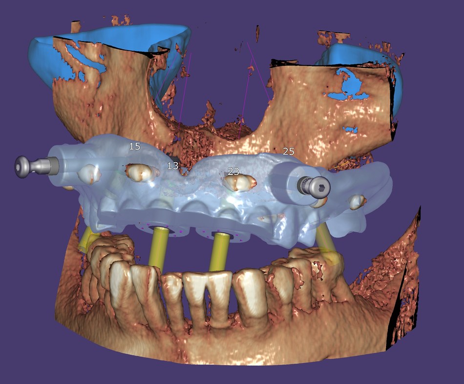 New exoplan 3.0 Galway Now Available