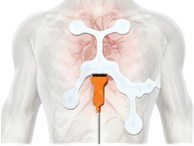 TridentCare Announces National Partnership for Mobile EKG Solution