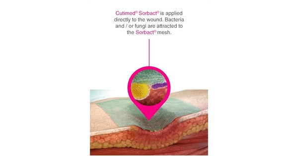 Essity Cutimed® Sorbact® Advanced Wound Care Products Receive ...