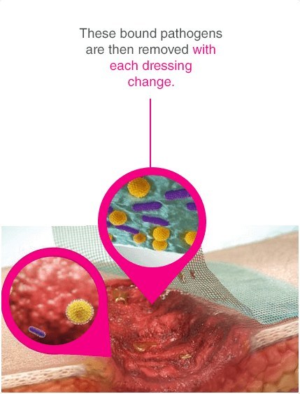 Essity Cutimed® Sorbact® Advanced Wound Care Products Receive ...