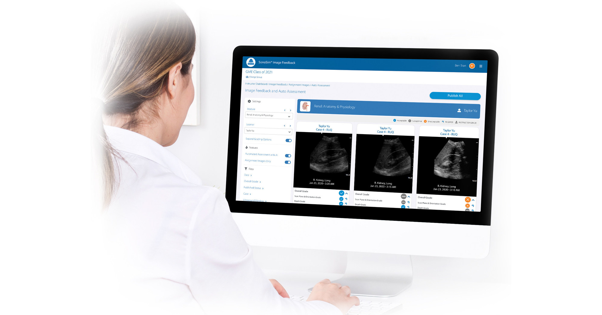 SonoSim AI Powered Automated Assessment Removes a Major Barrier to ...