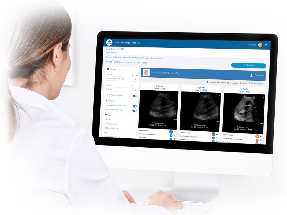 SonoSim AI Powered Automated Assessment Removes a Major Barrier to ...