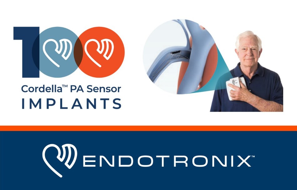 Endotronix Celebrates 100th Implant Of The Cordella™ Pulmonary Artery ...
