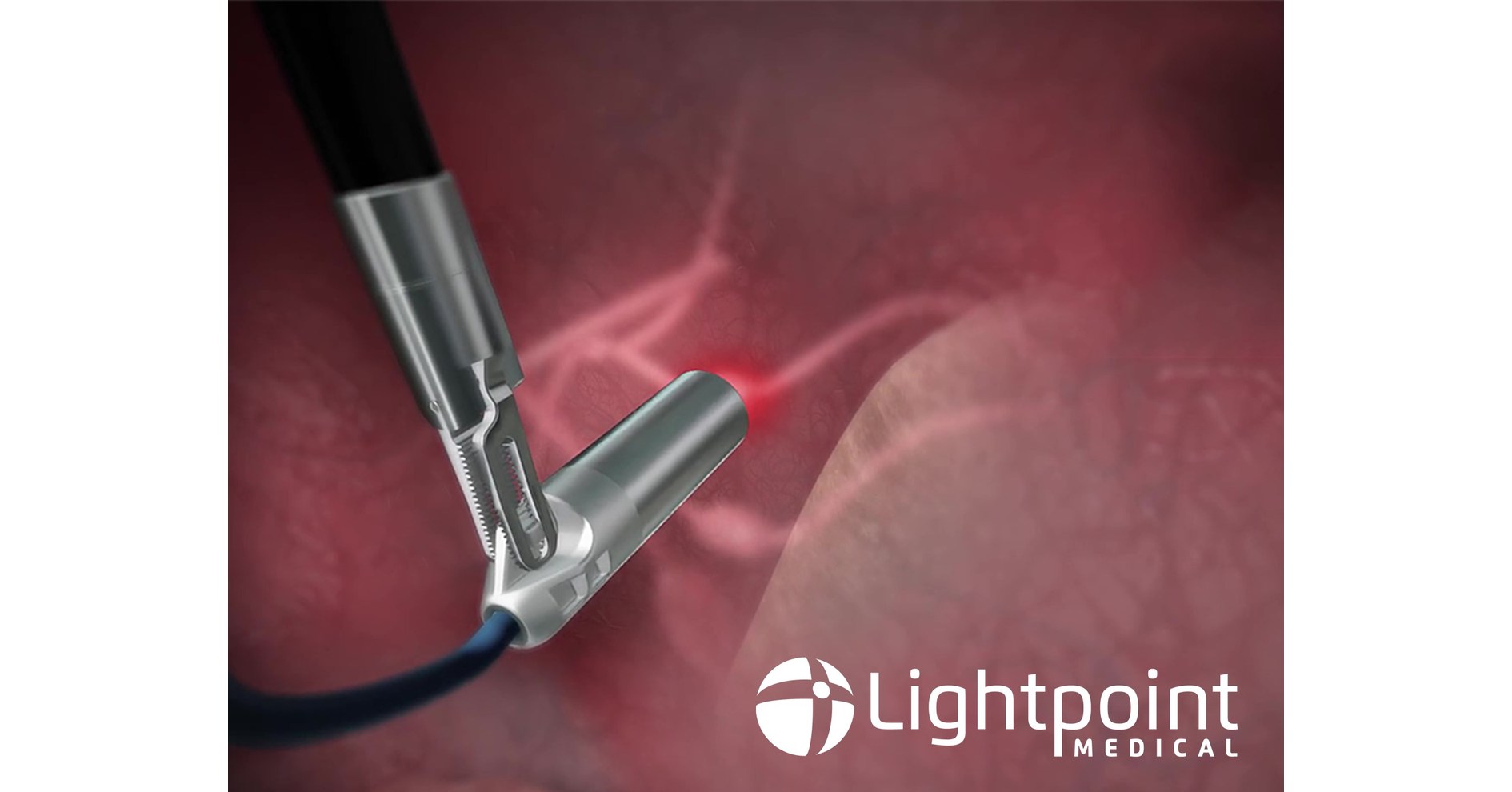 Lightpoint Medical Announces $8 Million in Funding to Support ...