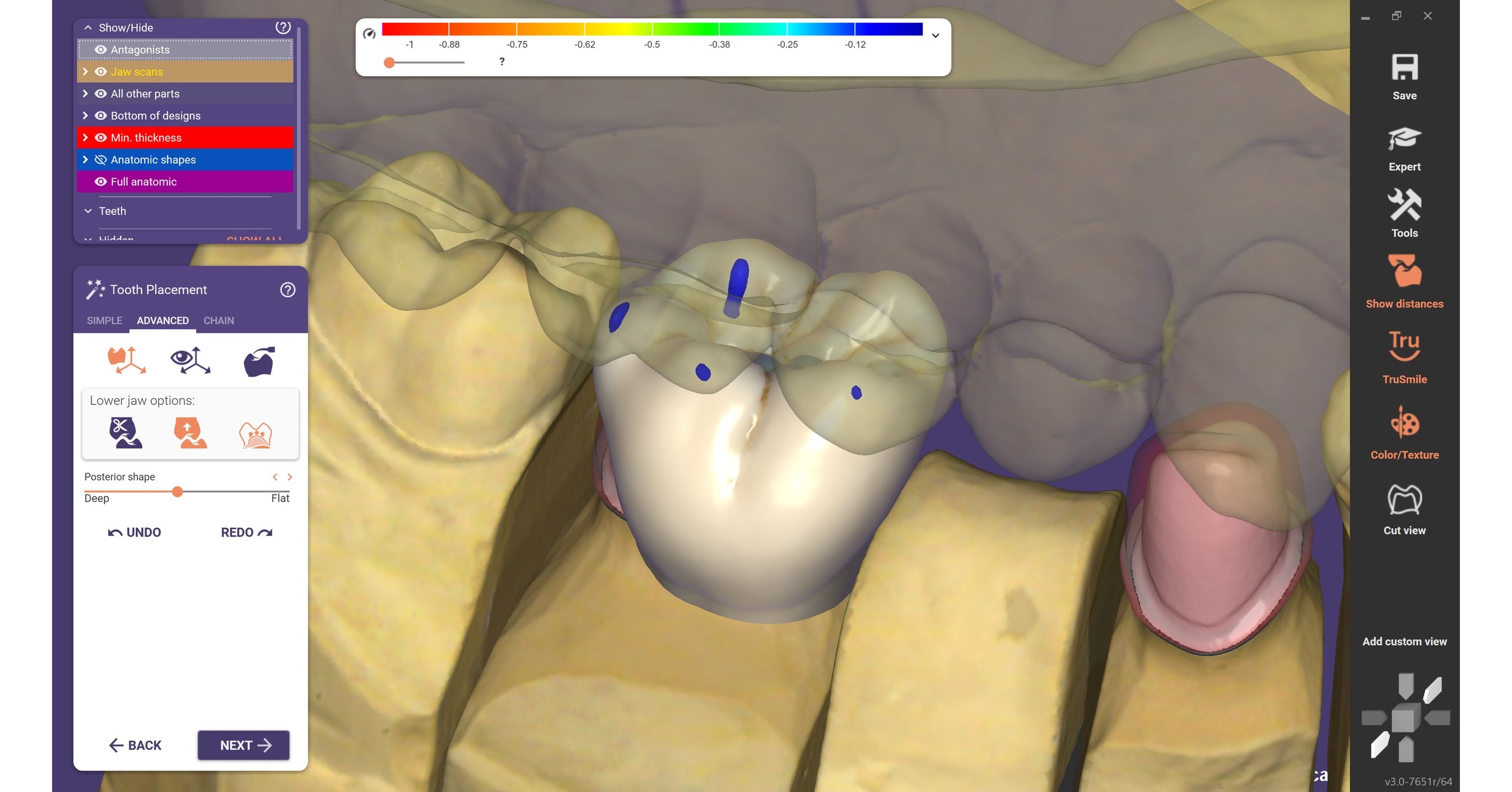 Exocad Wiki Model Creator Module Exocad