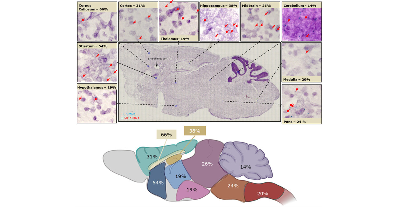 PYC Therapeutics Announces Preclinical Data Demonstrating Superior PPMO ...