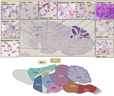 PYC Therapeutics Announces Preclinical Data Demonstrating Superior PPMO ...