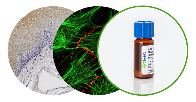 PROGEN signs non-exclusive distribution agreement for sales of research ...