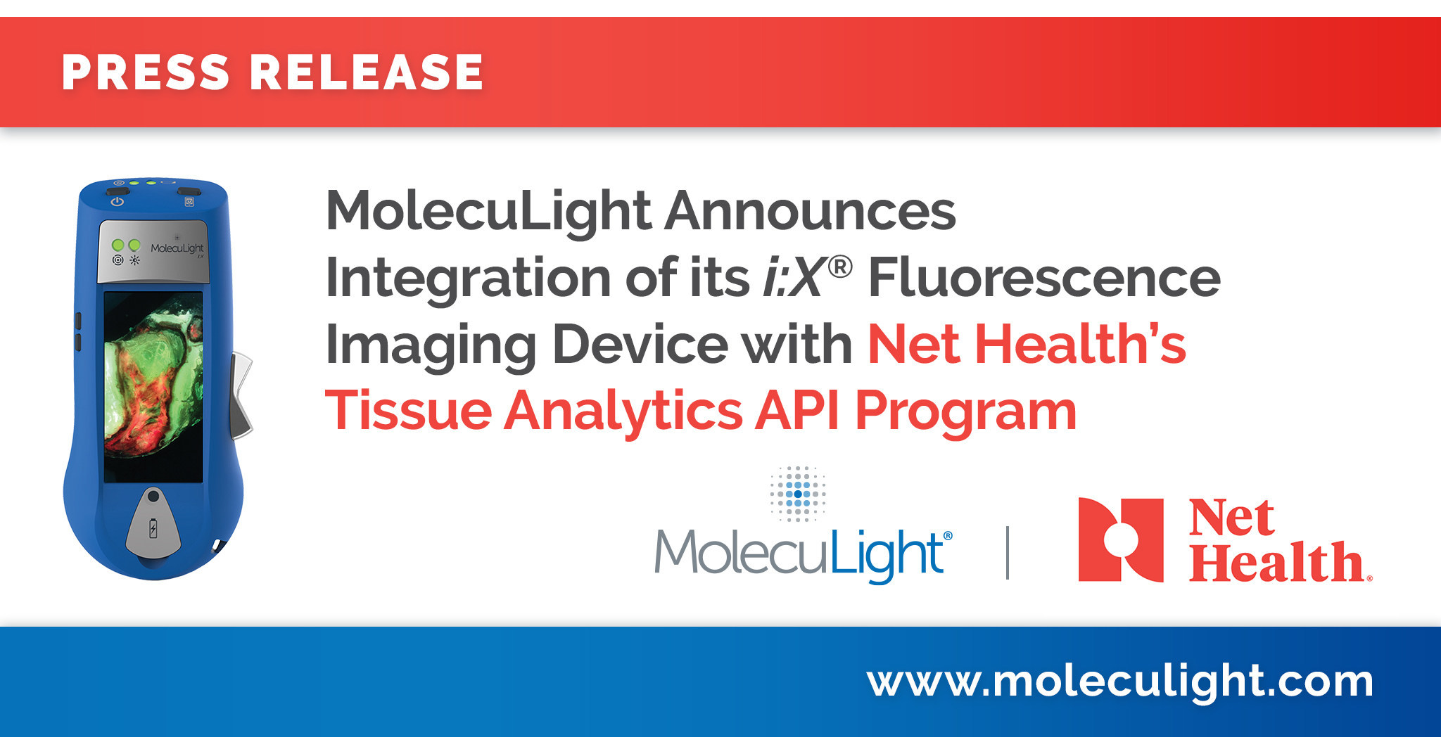 MolecuLight Announces Integration of its i:X® Fluorescence Imaging ...