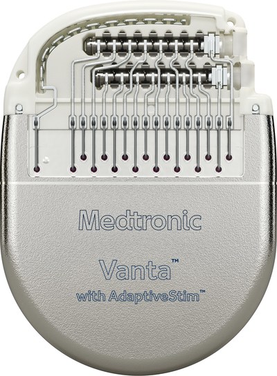 Medtronic Announces FDA Approval of its Next Generation Recharge-Free ...