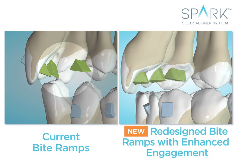 Spark Aligners récidive avec une innovation leader sur le marché et une ...