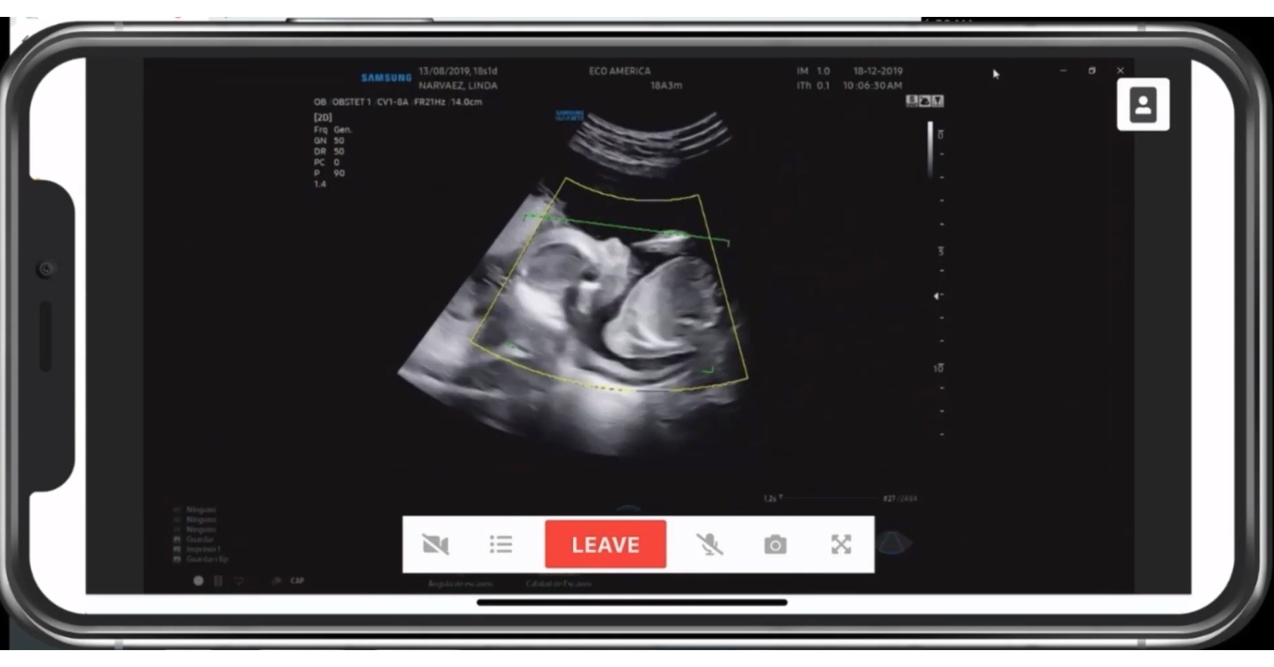 TeleRay Advises that POCUS Images Need to be Stored Properly for ...
