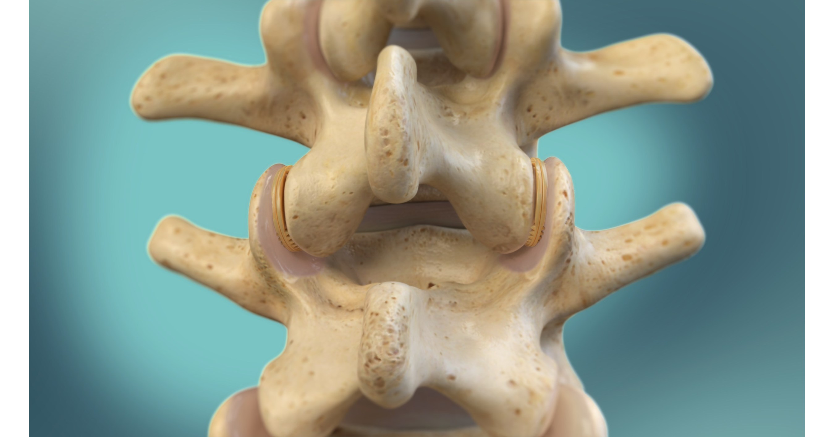 Zyga Announces Highmark, Inc., 4th Largest Blue Cross Blue Shield ...