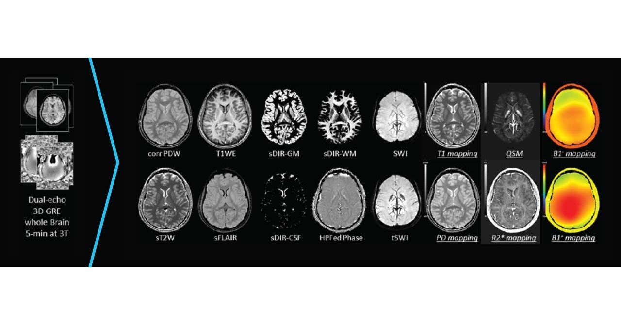 SpinTech MRI Earns FDA Clearance for Rapid, Quantitative Brain-Imaging ...