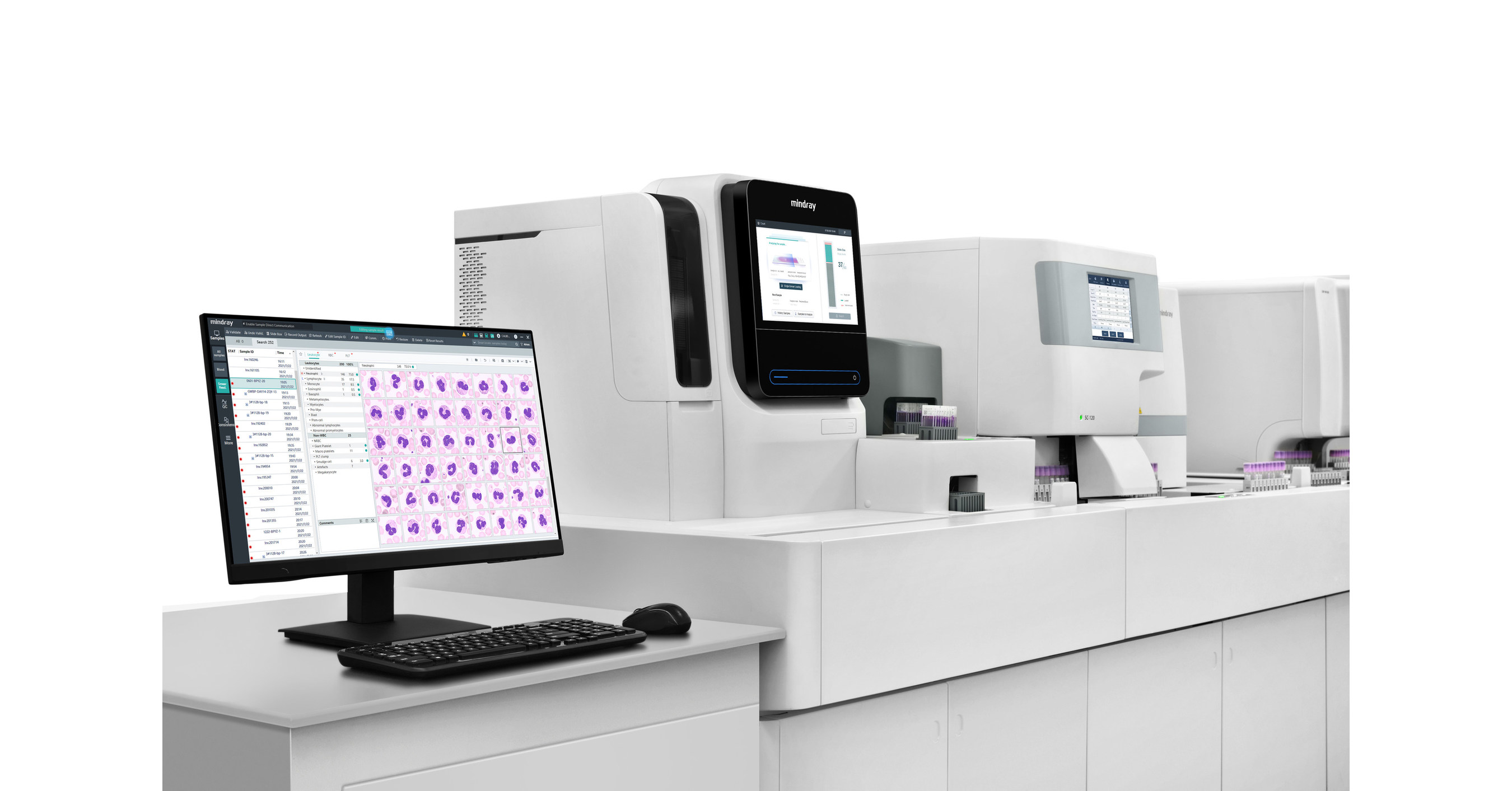 Mindray Launches New MC-80 Automated Digital Cell Morphology Analyzer ...