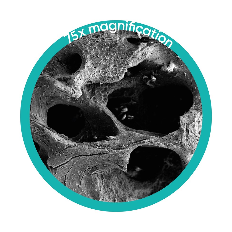 Neoss, Inc. is celebrating the launch of NeoGenix XP™