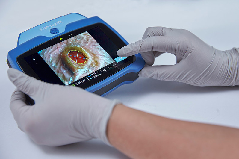 Launch of New MolecuLightDX™ Device to Enable Point-of-Care Imaging of ...