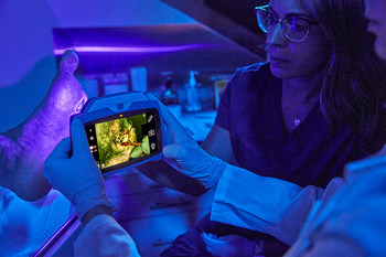 Launch of New MolecuLightDX™ Device to Enable Point-of-Care Imaging of ...