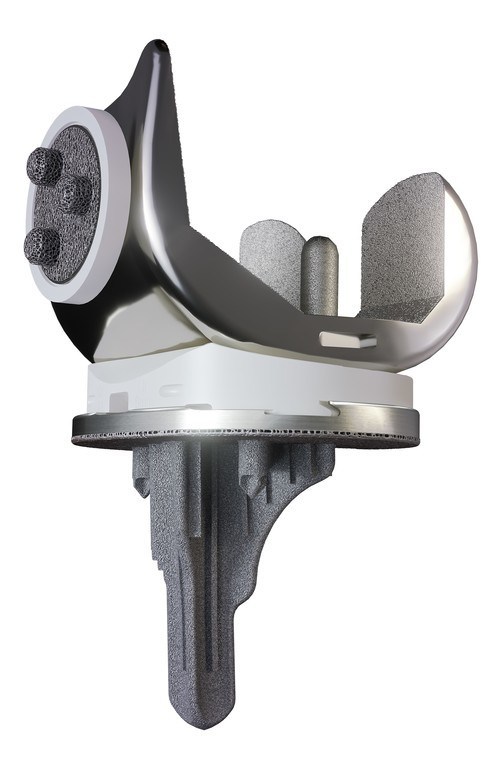 Smith+Nephew introduces the LEGION™ CONCELOC™ Cementless Total Knee ...