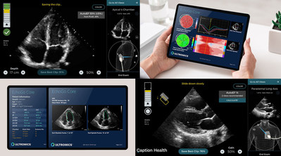 Caption Health and Ultromics Partner to Put Heart Disease Detection and ...