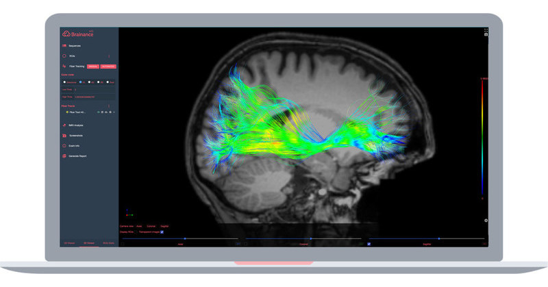 Advantis Medical Imaging Receives FDA Clearance for Brain MRI Analysis ...