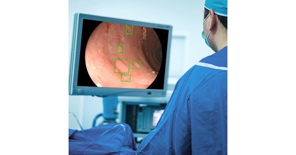 Medtronic receives Health Canada licence for GI Genius™ intelligent ...