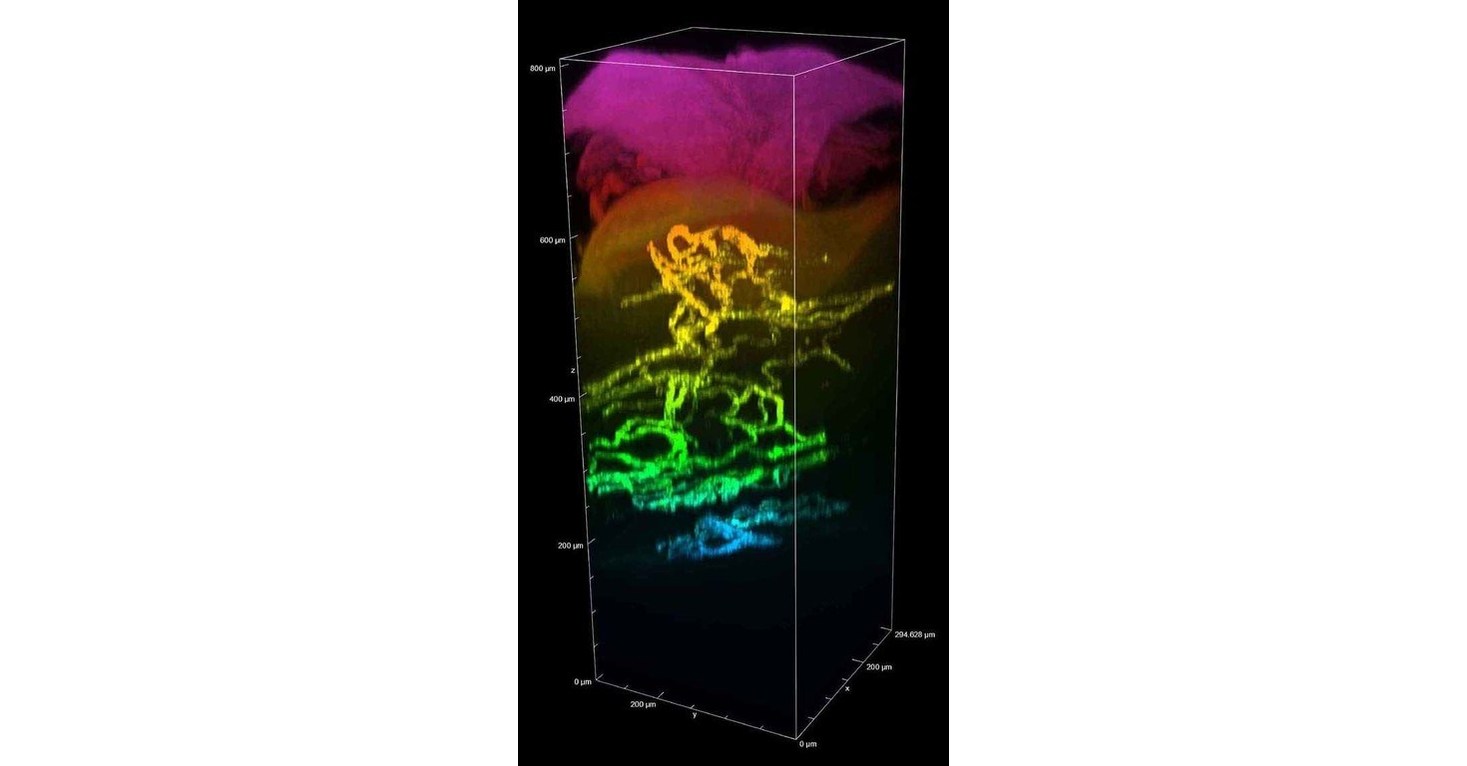 Nikon introduces the new AX R MP multiphoton confocal microscope
