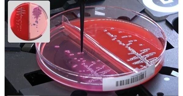 Colibri™ Automated Specimen Workup Instrument by COPAN Receives FDA 510 ...