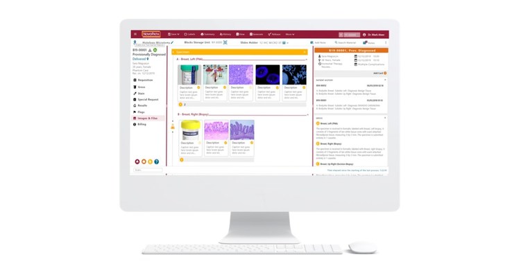 NovoPath LLC Redefines Laboratory Information Systems with 2022 Release ...