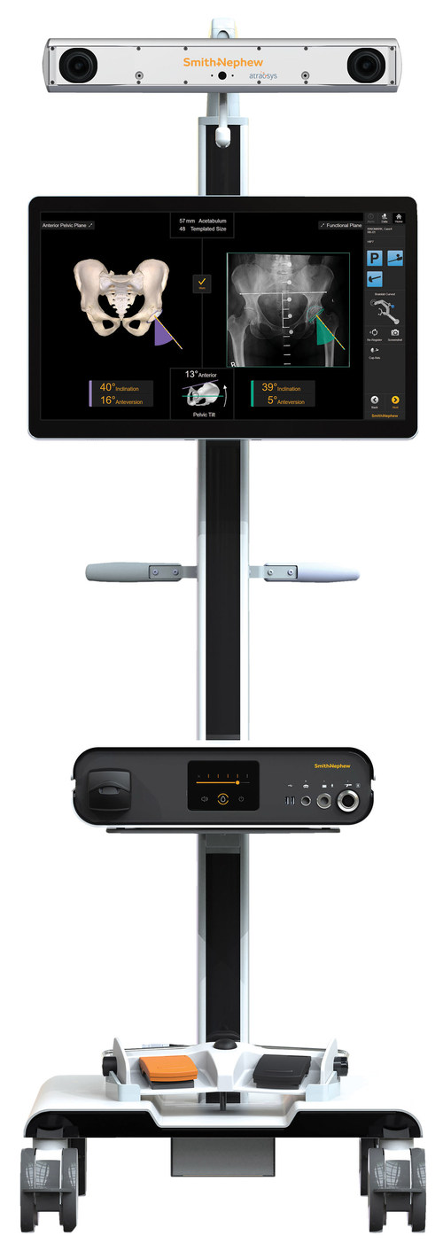 Smith+Nephew expands next-generation handheld robotic-assisted CORI ...