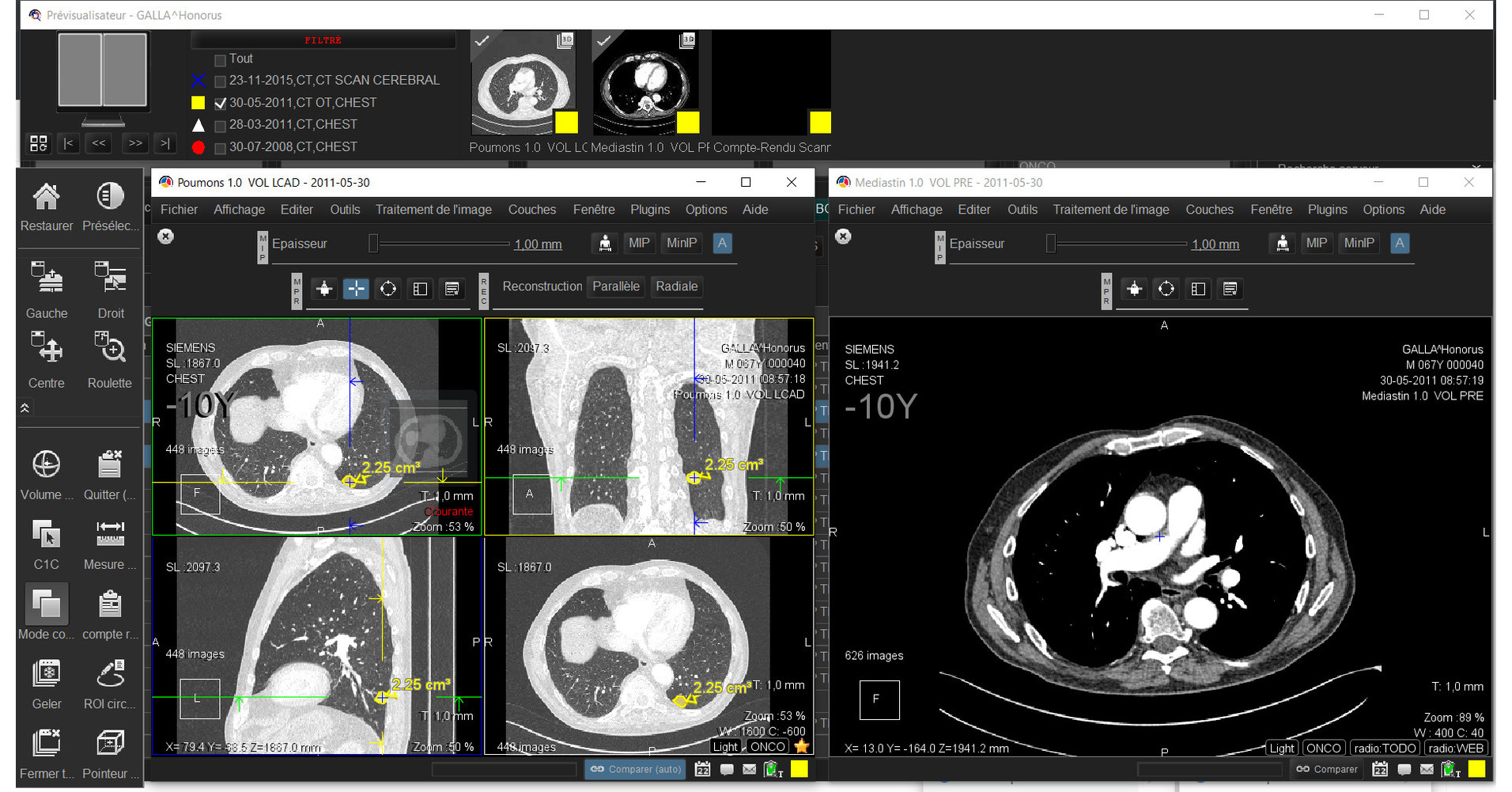 Telemis makes further enhancements to its flagship PACS/MACS software ...