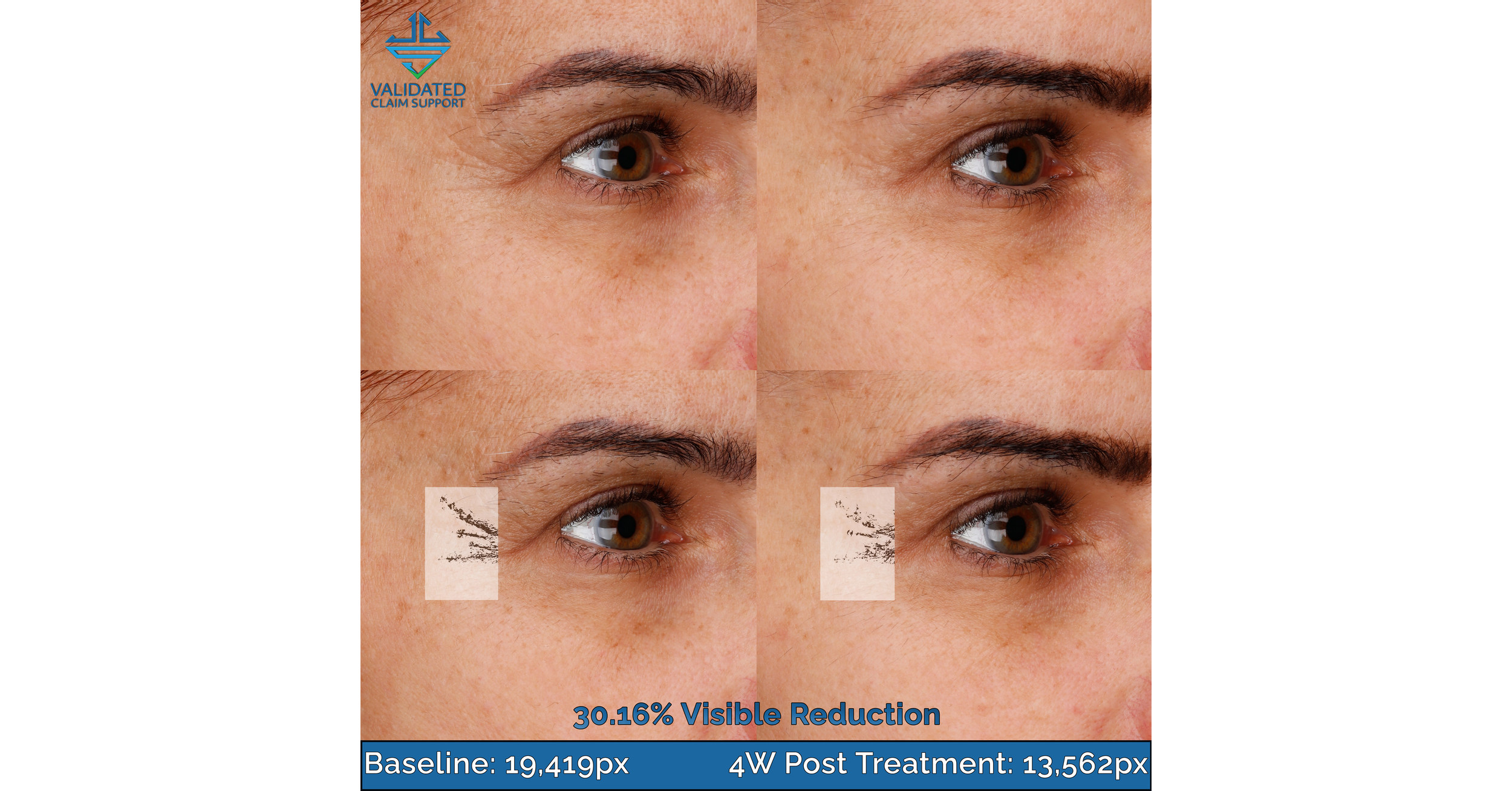 Validated Claim Support Expands Before and After Clinical Imaging ...