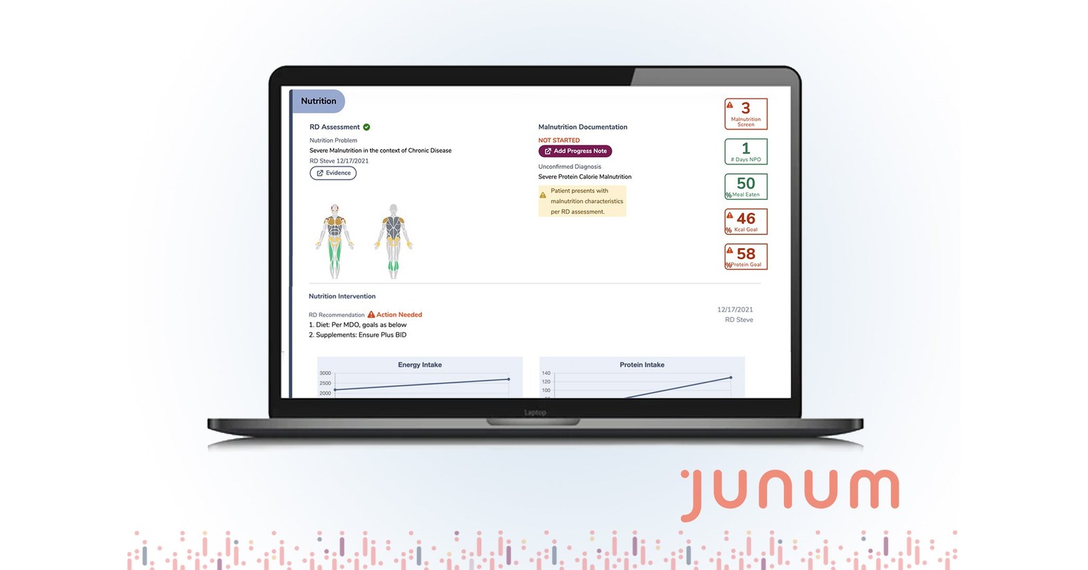 Junum Releases Updated MalnutritionCDS™ Solution on Epic App Orchard
