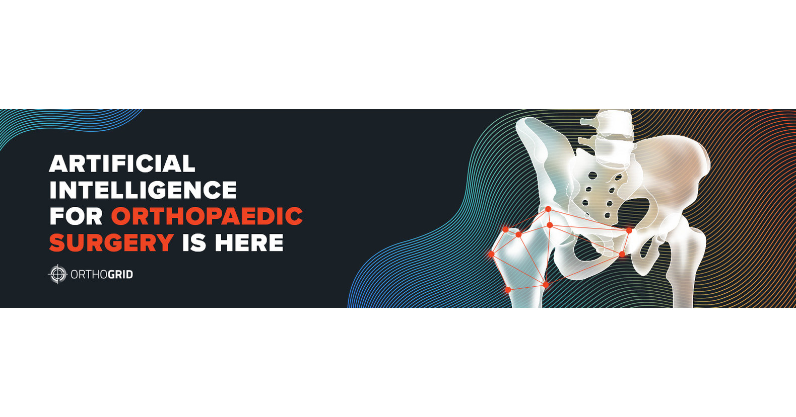 OrthoGrid Brings the Power of Artificial Intelligence to Orthopedics!