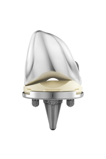 DePuy Synthes Further Reimagines Knee Restoration with the Addition of ...