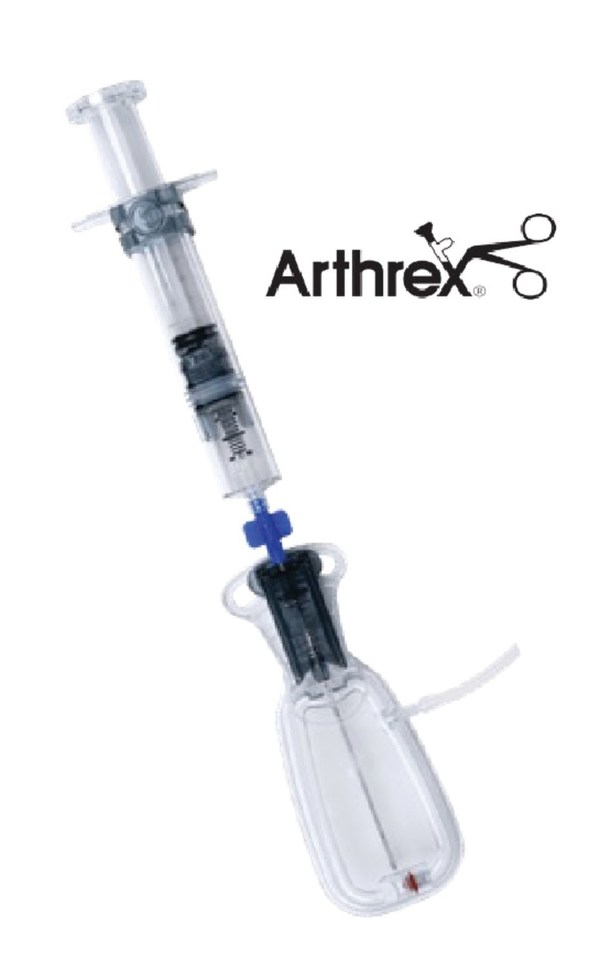ARTHREX LICENSES EXCLUSIVE RIGHTS FROM BIMINI HEALTH TECH TO GLOBALLY ...