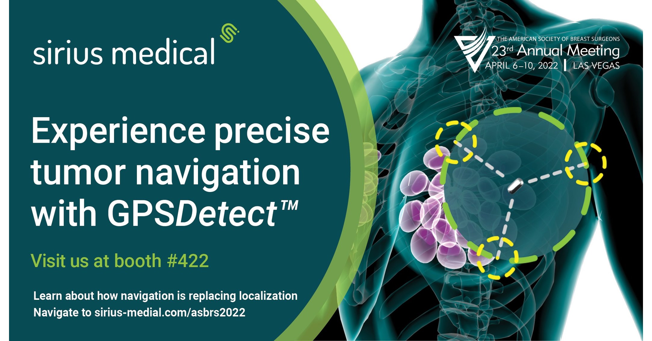 Sirius Medical Debuts at Major U.S. Breast Surgeons Conference