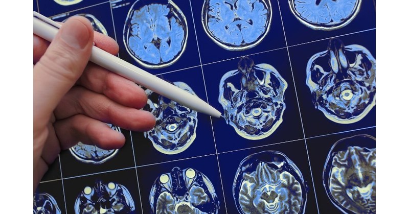 John Theurer Cancer Center Treats First Patient in U.S. with ...