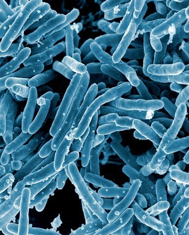 Texas Biomed selected as premier national tuberculosis research center