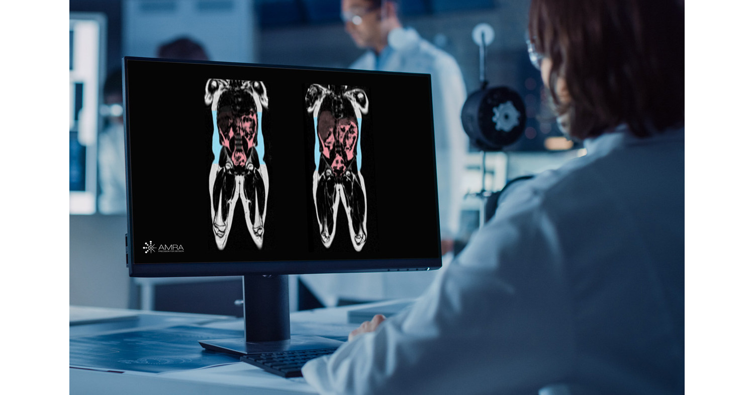 AMRA Medical's MRI-based body composition measurements used in Lilly's ...