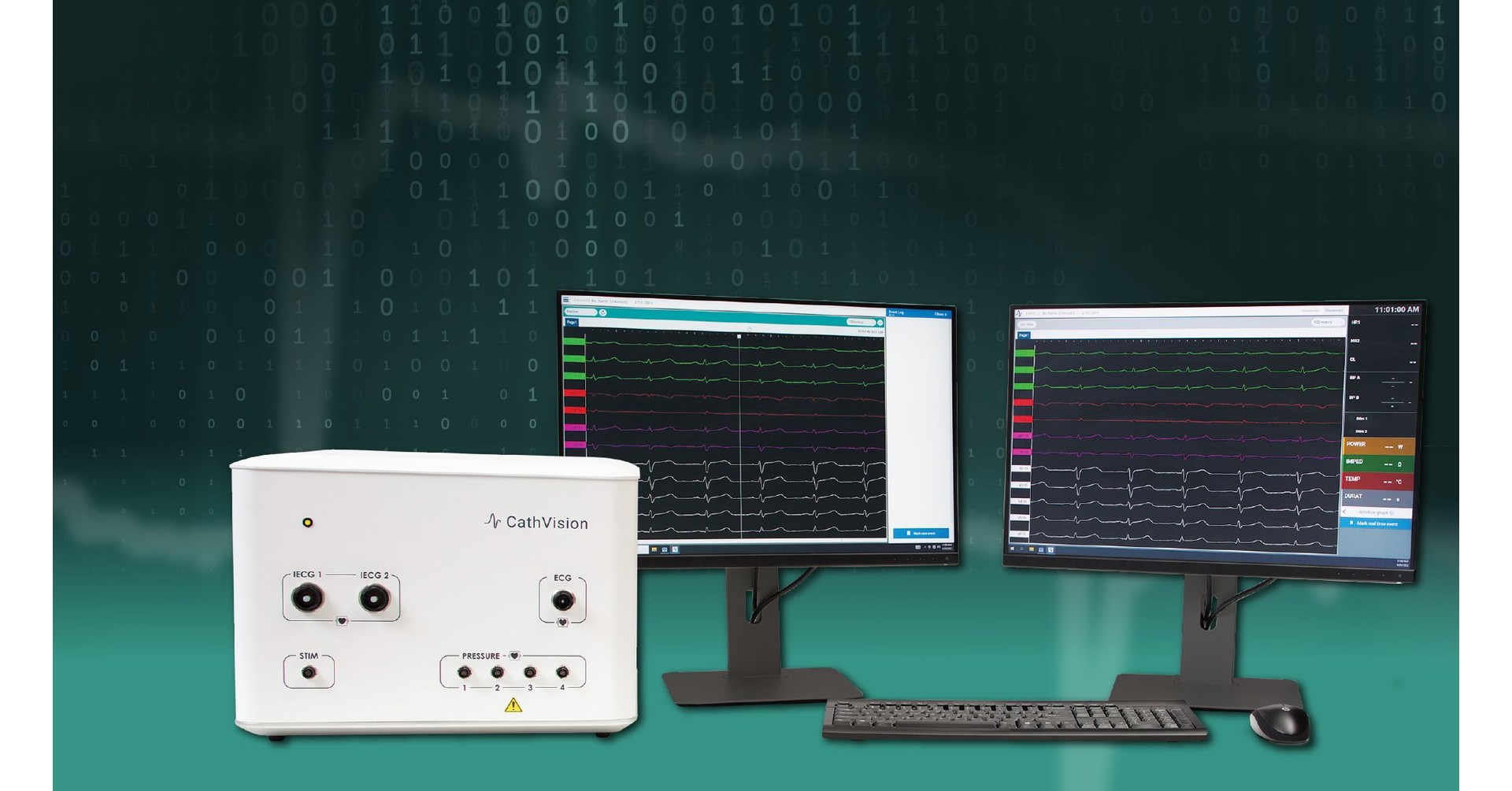 CathVision Announces FDA Clearance of ECGenius™ High-Fidelity, Low ...