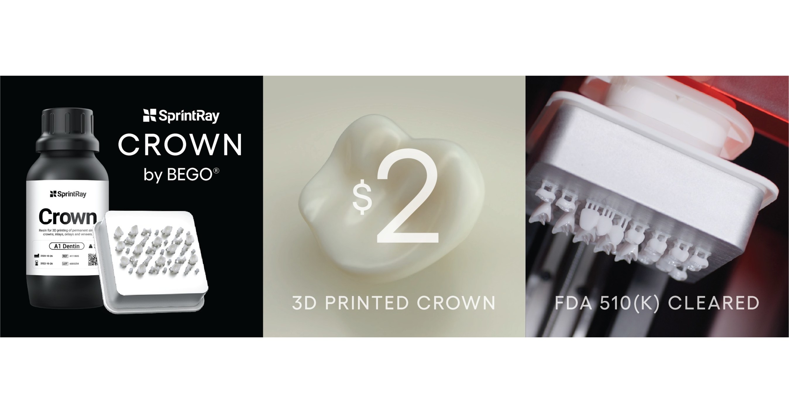 SprintRay's latest resin will make restorative 3D printing more ...