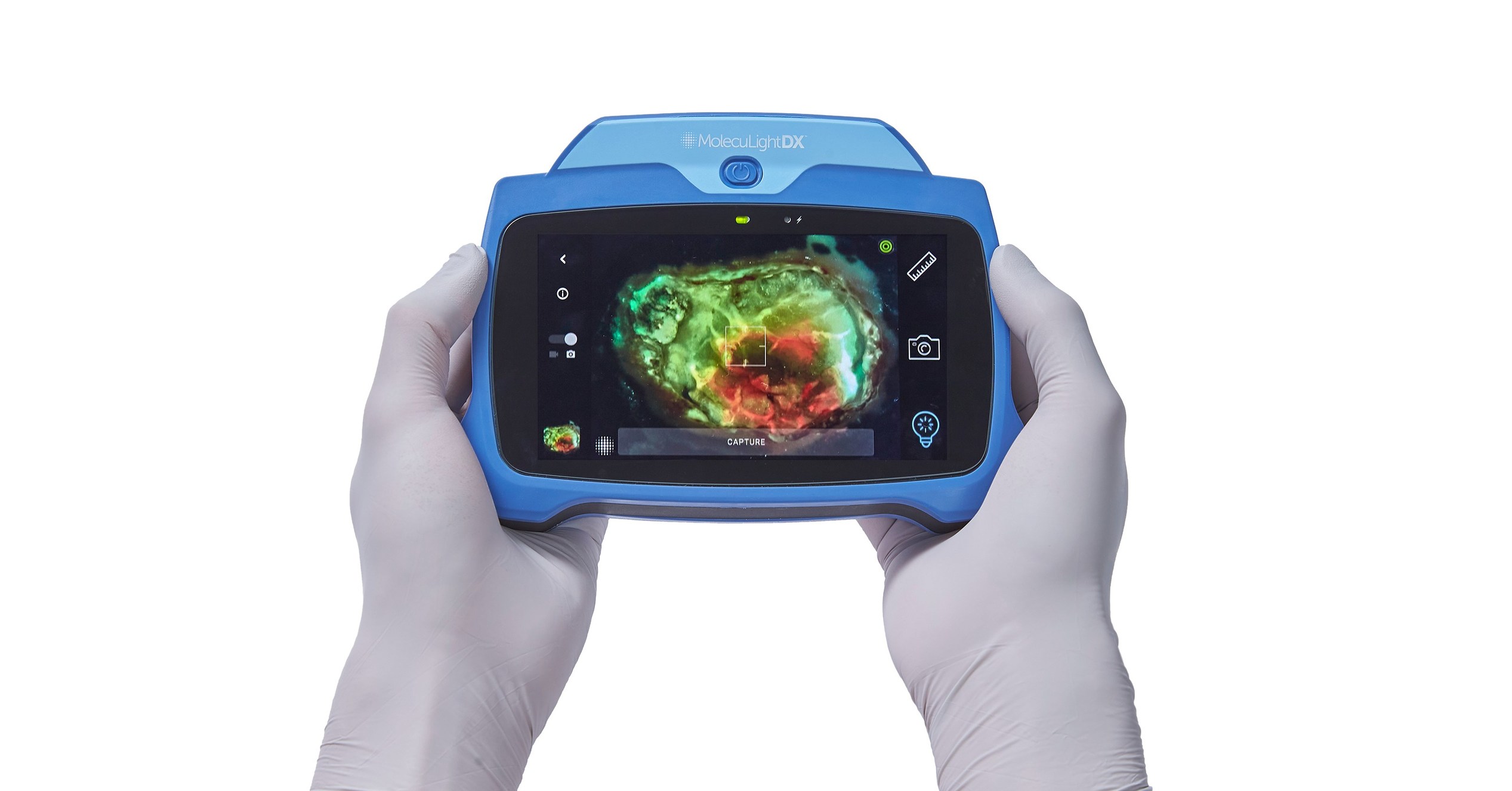 MolecuLight Awarded Point-of-Care Wound Imaging Devices Agreement with ...