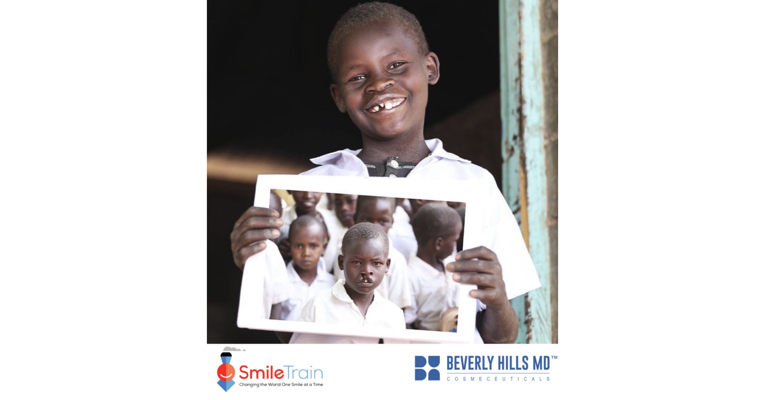 BEVERLY HILLS MD PROVIDES 3000 SMILES TO CHILDREN'S CHARITY, SMILE TRAIN