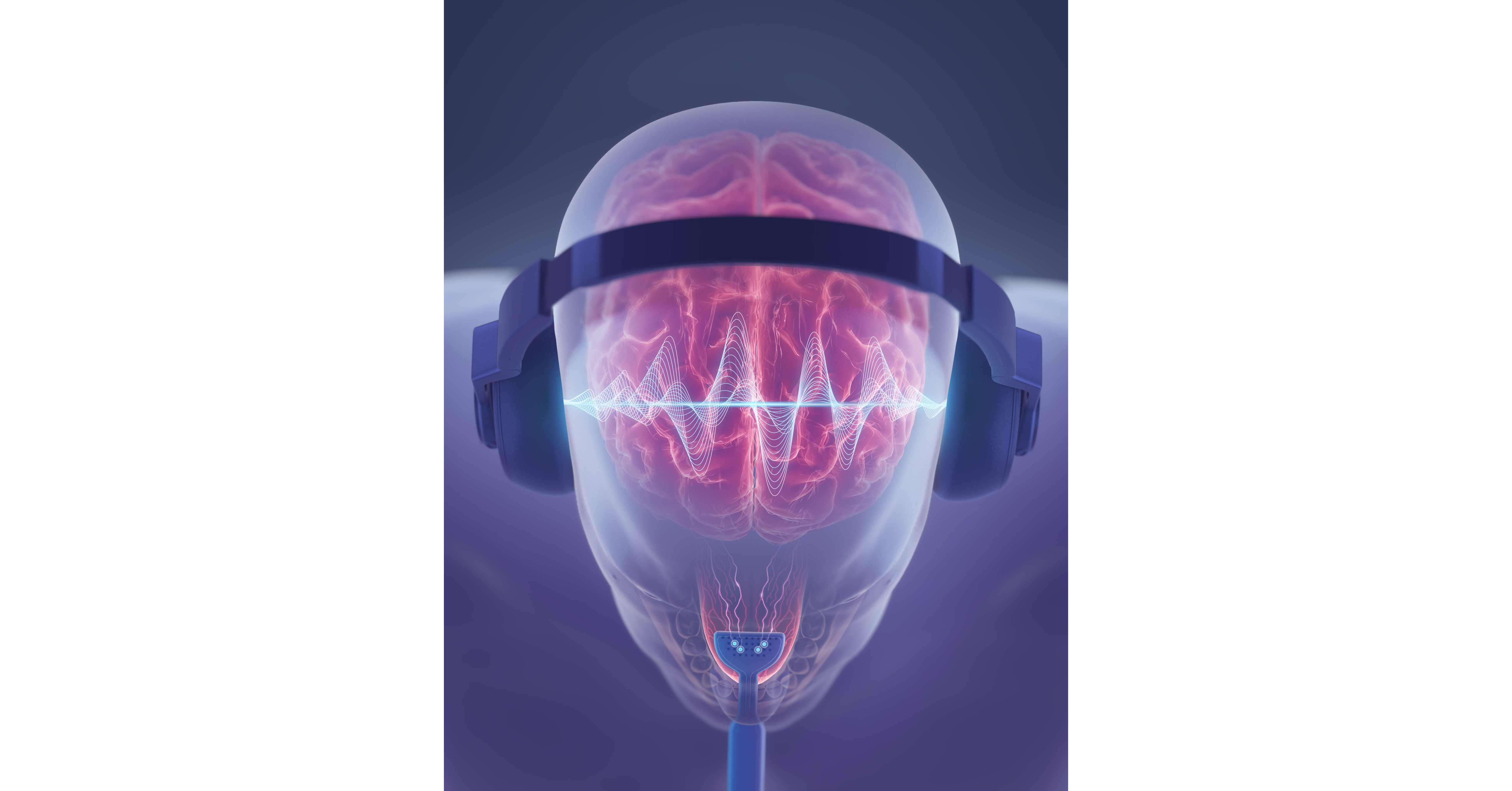 Neuromod Publishes Results of Second Large Scale Clinical Trial for ...