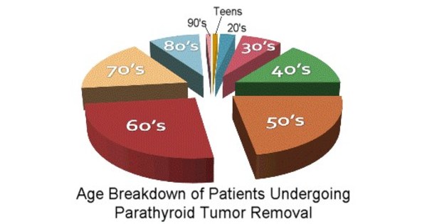 1 in 50 Women Will Suffer From Parathyroid Disease