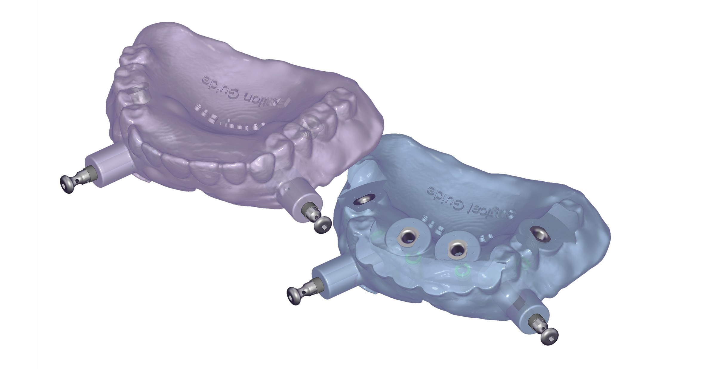 EXOCAD RELEASES EXOPLAN 3.0 GALWAY SOFTWARE IN THE UNITED STATES