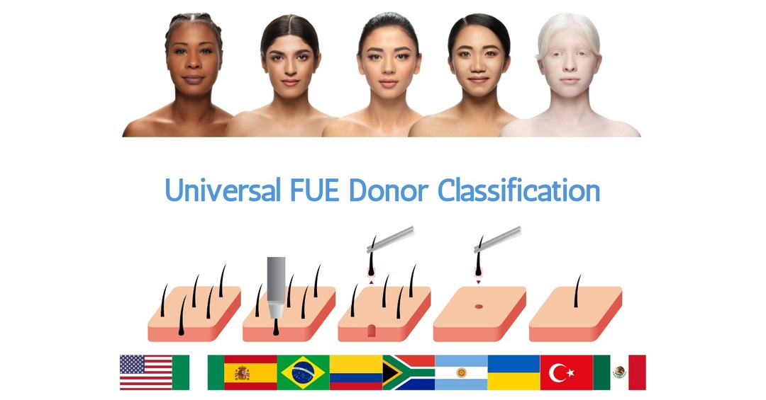 A New FUE Classification System for Predicting Challenges in Hair ...