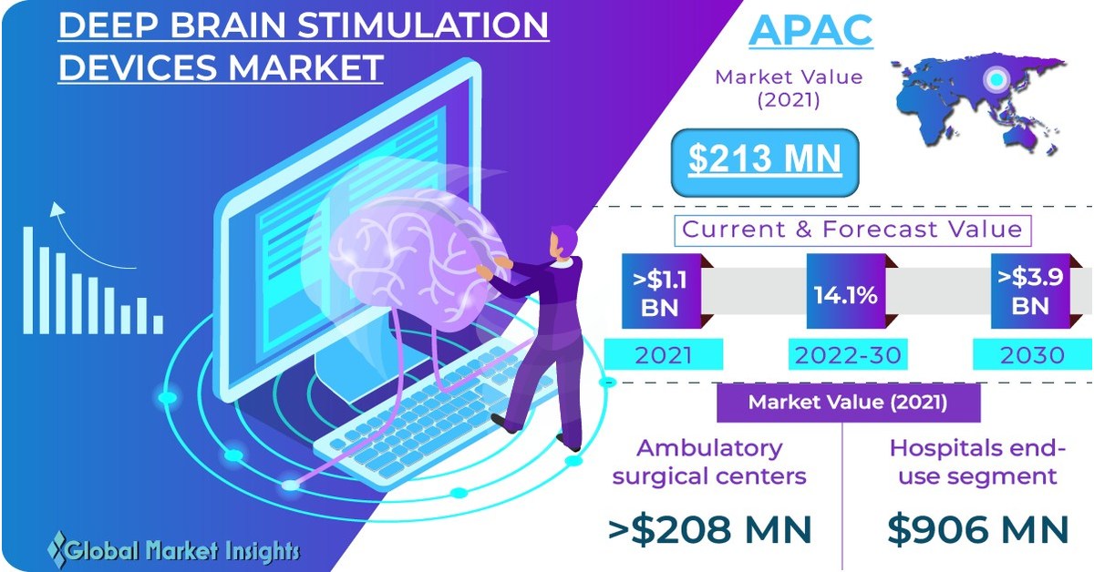 Deep Brain Stimulation Devices Market to hit USD 3.9 billion by 2030 ...