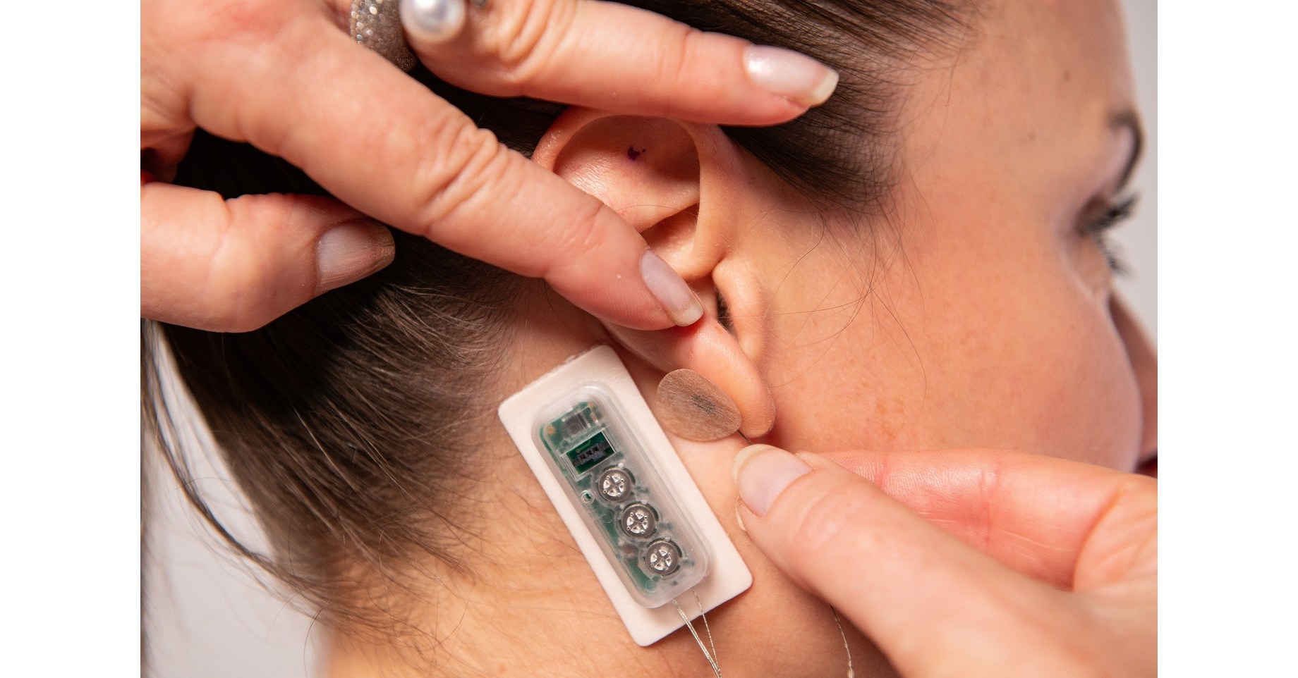 FDA Clears DyAnsys Neurostimulation Device First Relief to treat ...